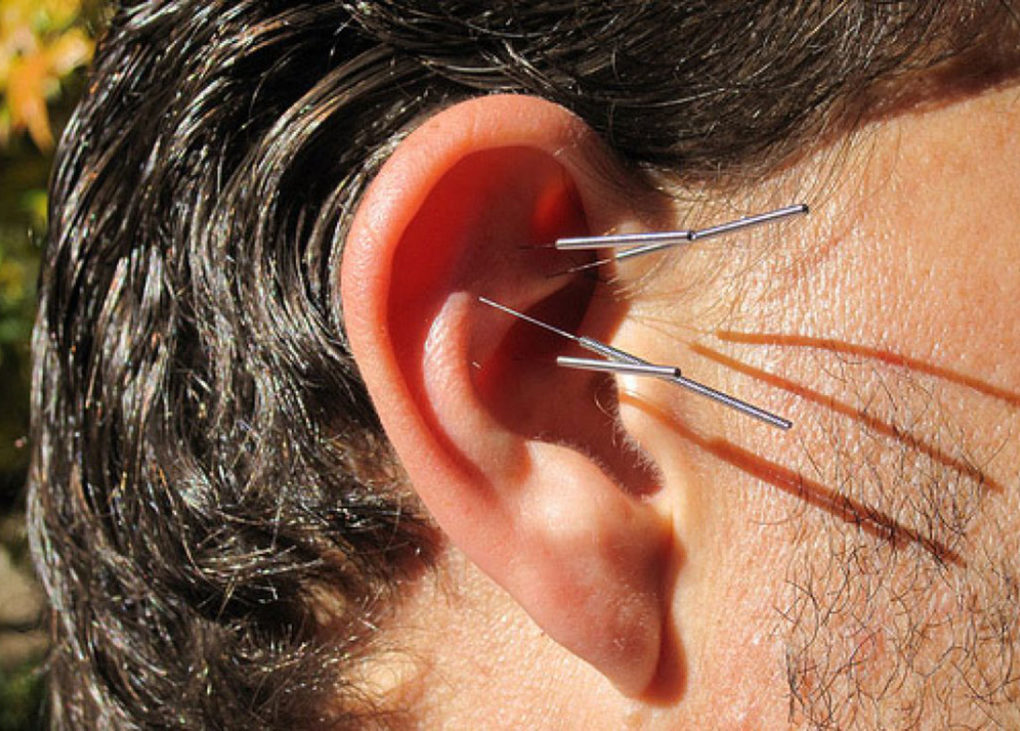 Tingkat Kebisingan Suara - Blog - Pusat Alat Bantu Dengar Indonesia